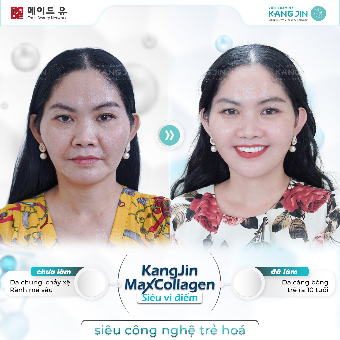 Viện thẩm mỹ Kangjin đón đầu xu thế tương lai về công nghệ trẻ hóa