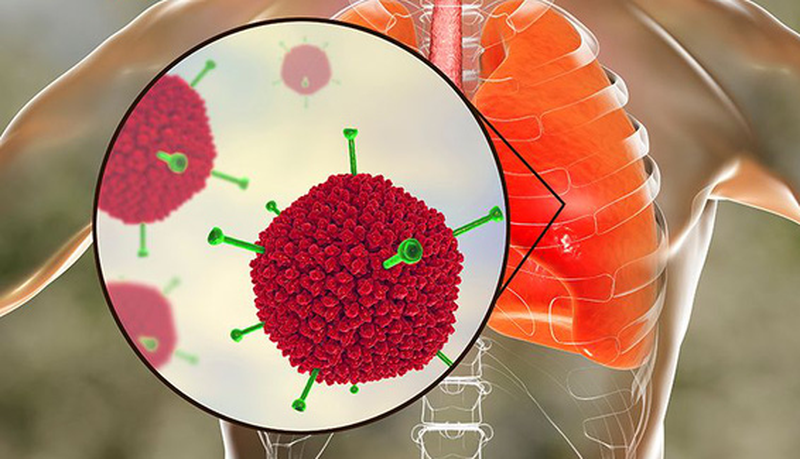 Thực hư virus Adeno khiến 6 trẻ tử vong nguy hiểm như thế nào? Chuyên ...