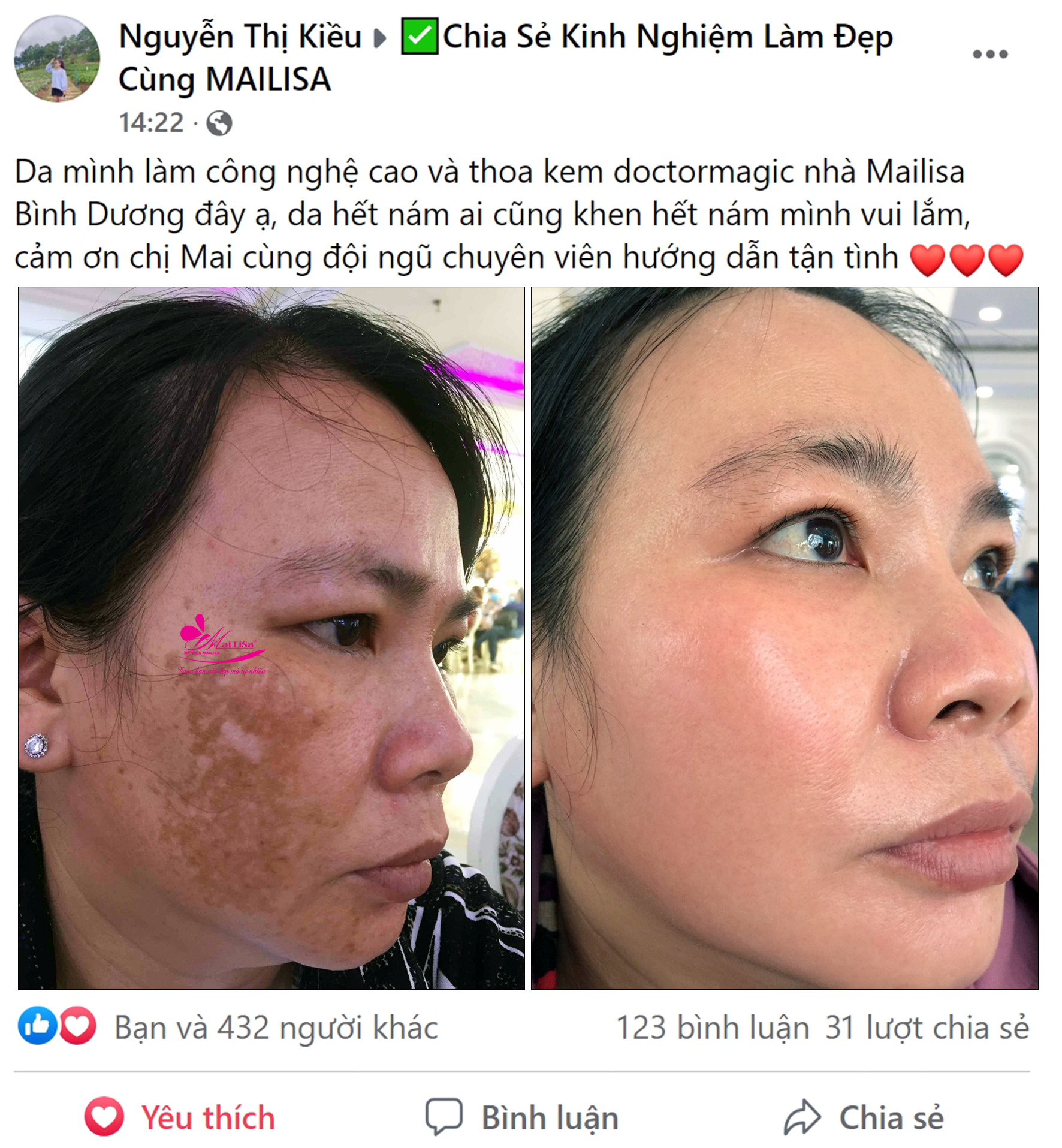 Điều trị da của Mailisa có được cấp phép hay không?