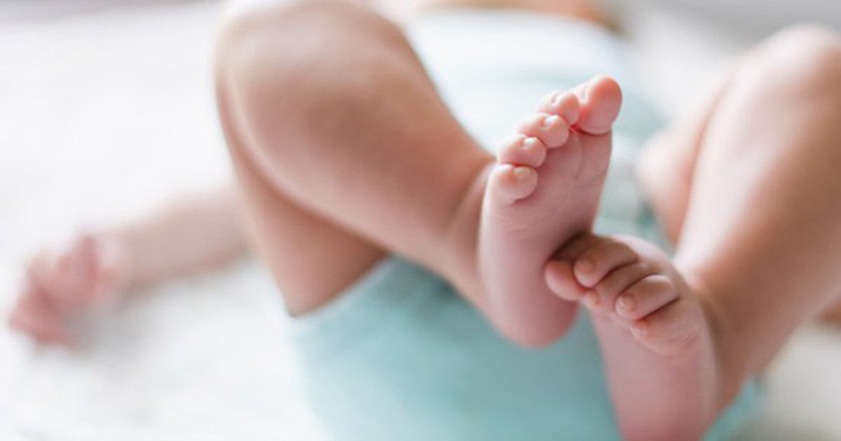 Khoèo chân bẩm sinh điều trị như thế nào?