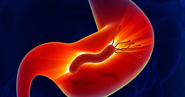 Người đàn ông từng mắc viêm dạ dày đi khám phát hiện cùng lúc 5 bệnh từ ...